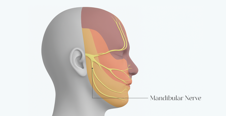 Typical Symptoms of Nerve Damage After Root Canal Treatment